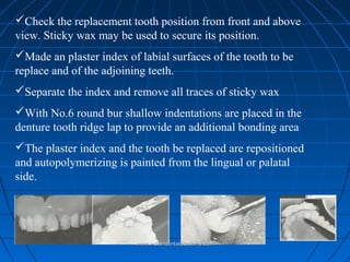 Repair of complete dentures/ Labial orthodontics | PPT