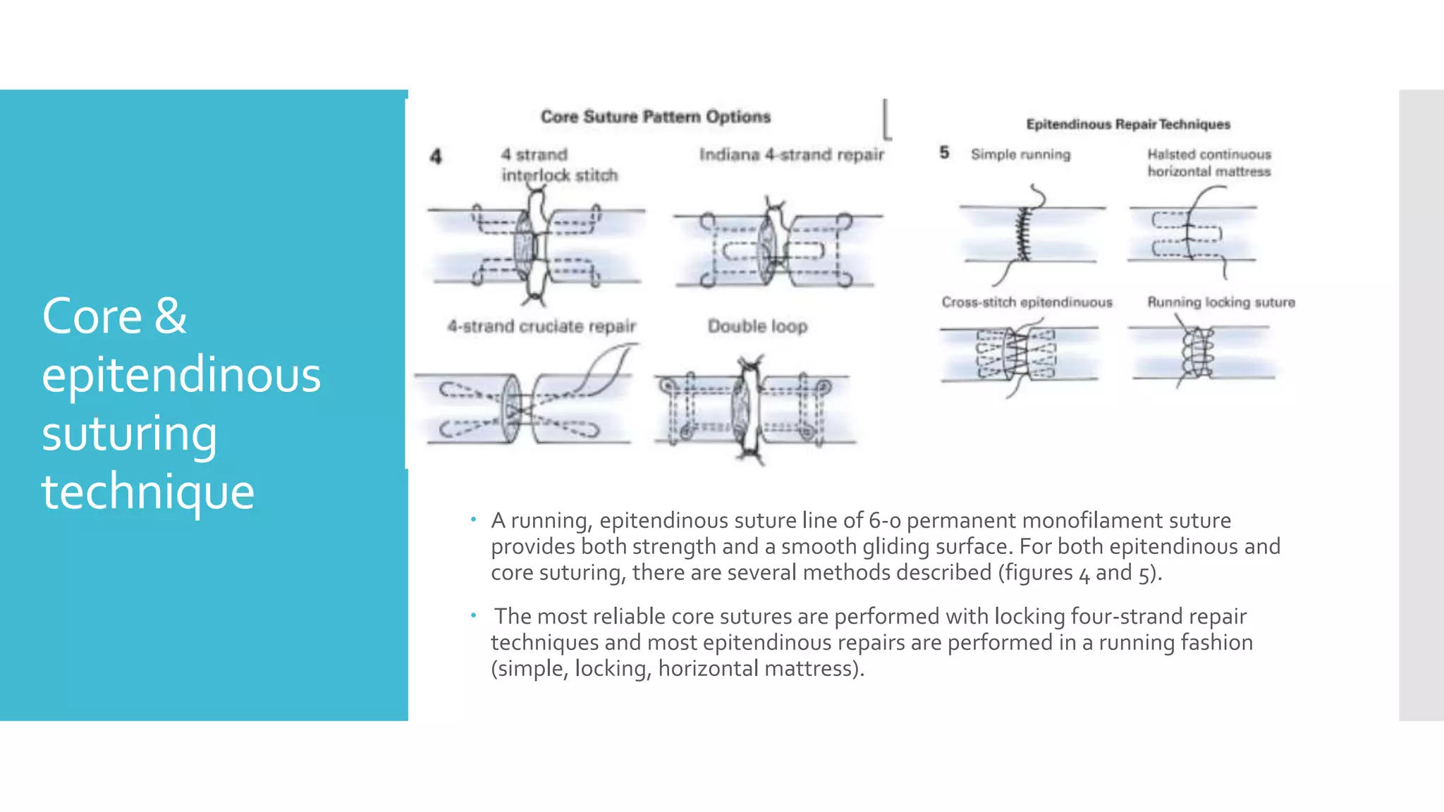 Repair tendon | PPTX