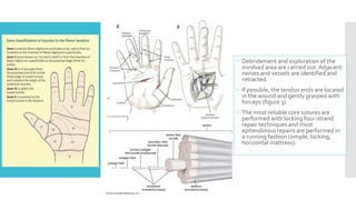 Repair tendon | PPT