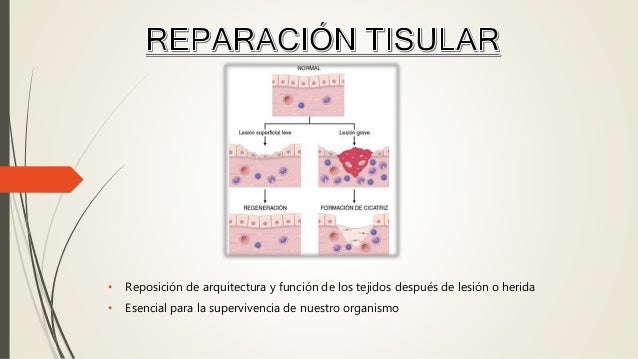 Renovacin Reparacin Y Regeneracin Tisular Renovación y reparación ...