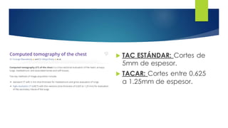 Repaso tacar toracica y patrones | PDF
