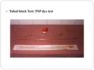 Repeat breeding Dr Ashiq | PPTX