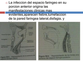 Repercusiones general de la patologia oral | PPTX