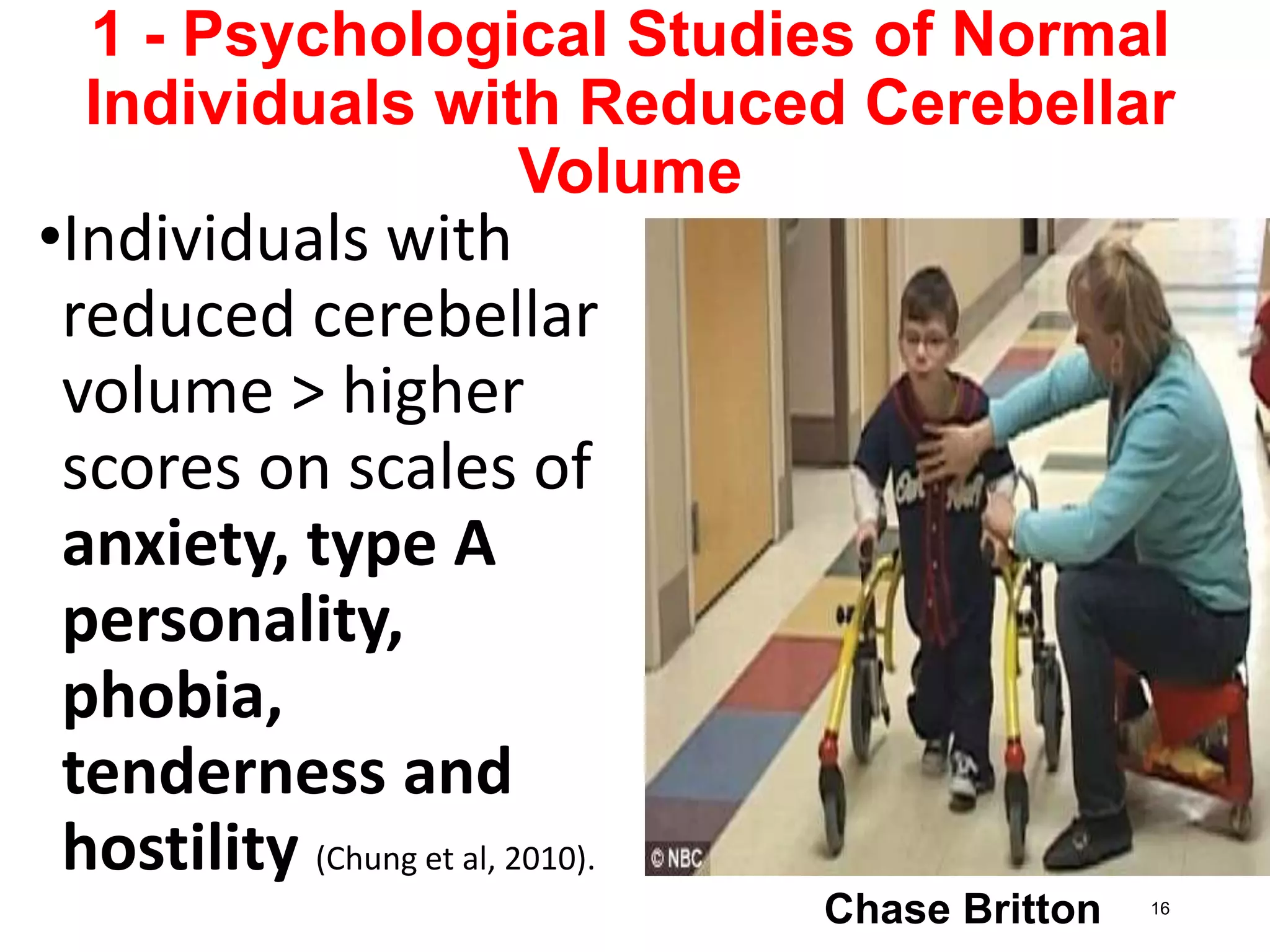 Repetitive behaviour in autism: a neurobehavioural approach | PPTX