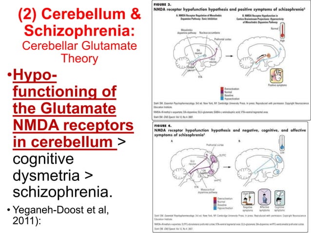 Repetitive behaviour in autism: a neurobehavioural approach | PPTX