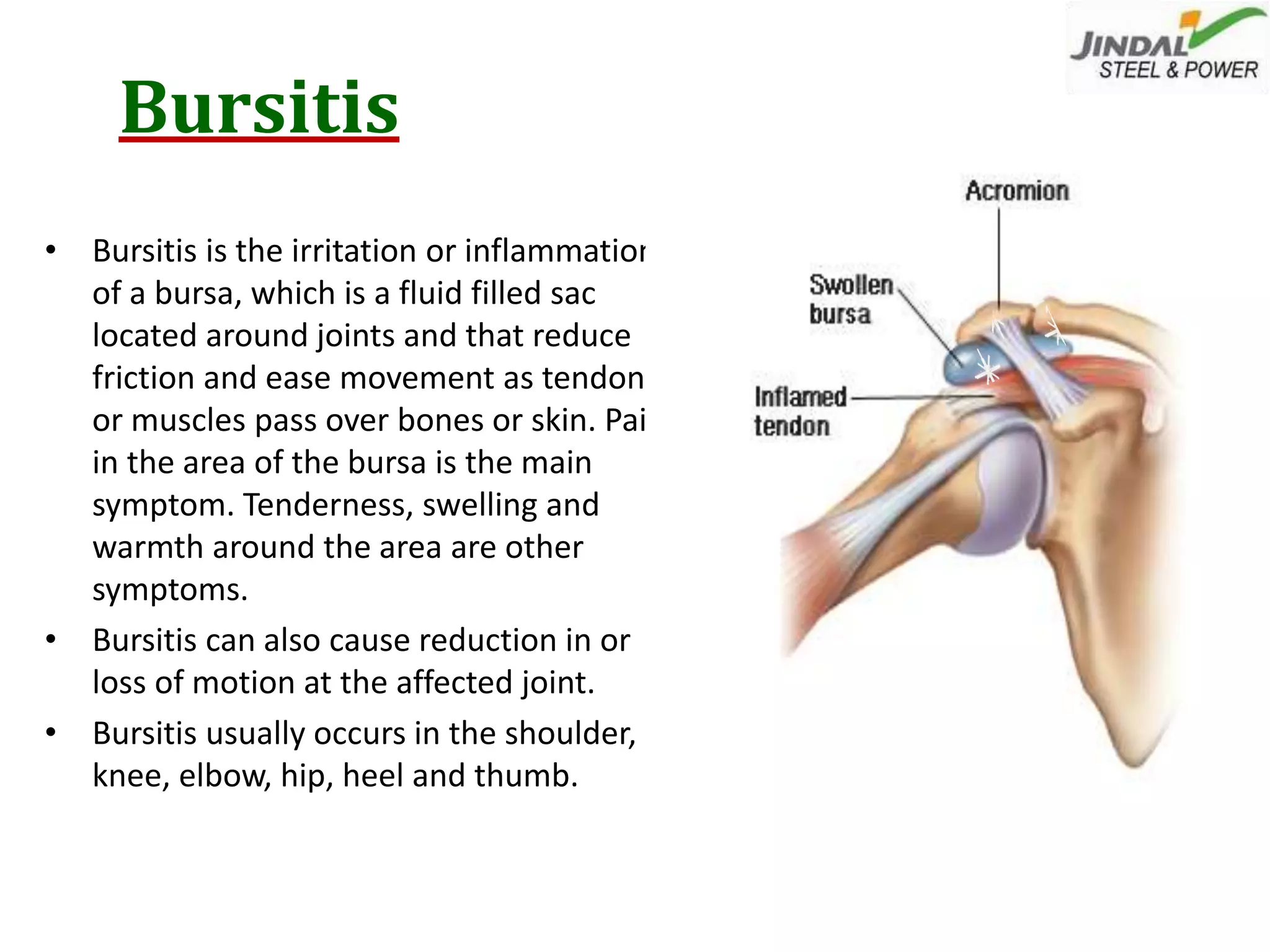 Repetitive stress injuries, prevention & management | PPTX