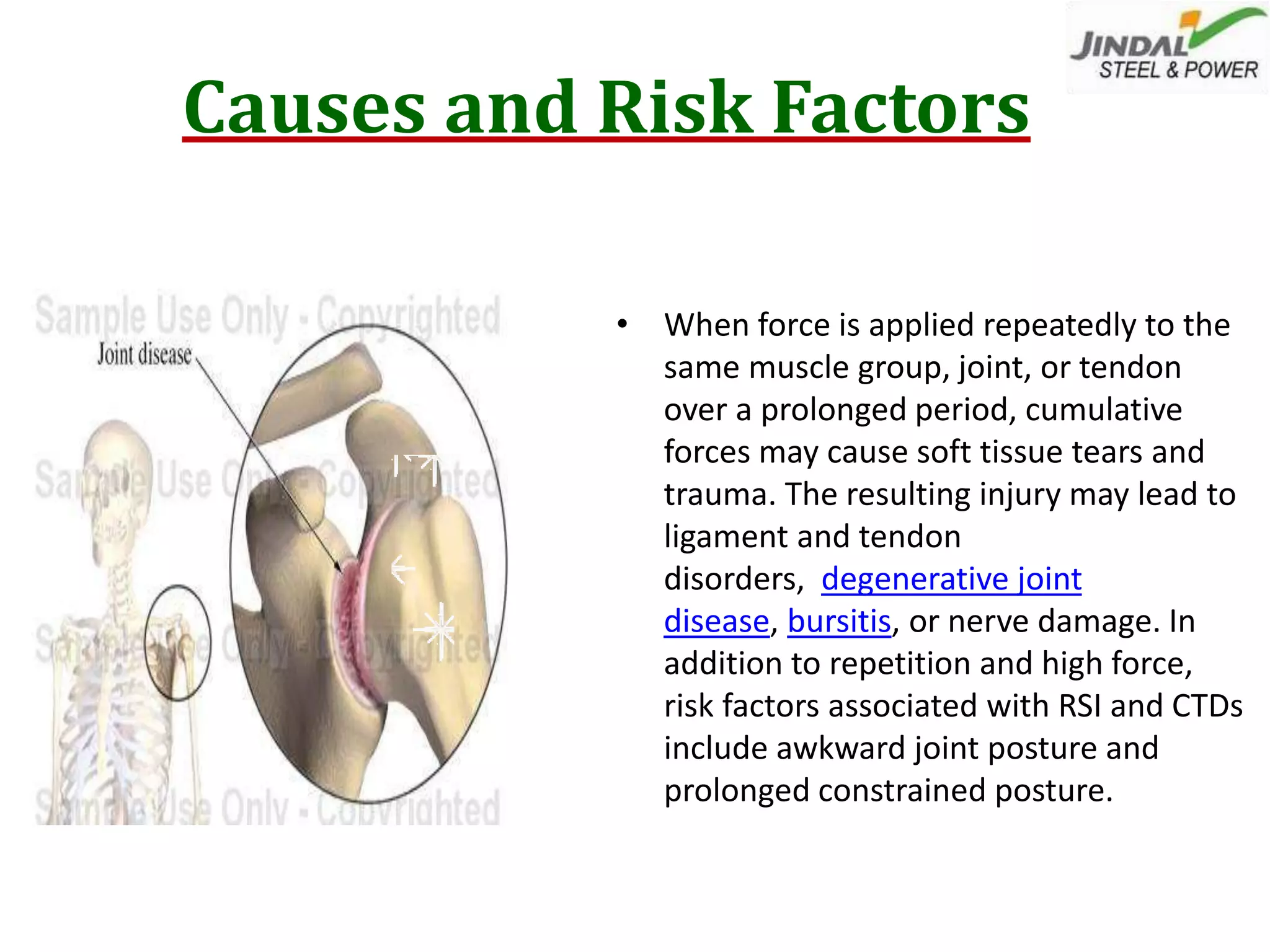 Repetitive stress injuries, prevention & management | PPTX