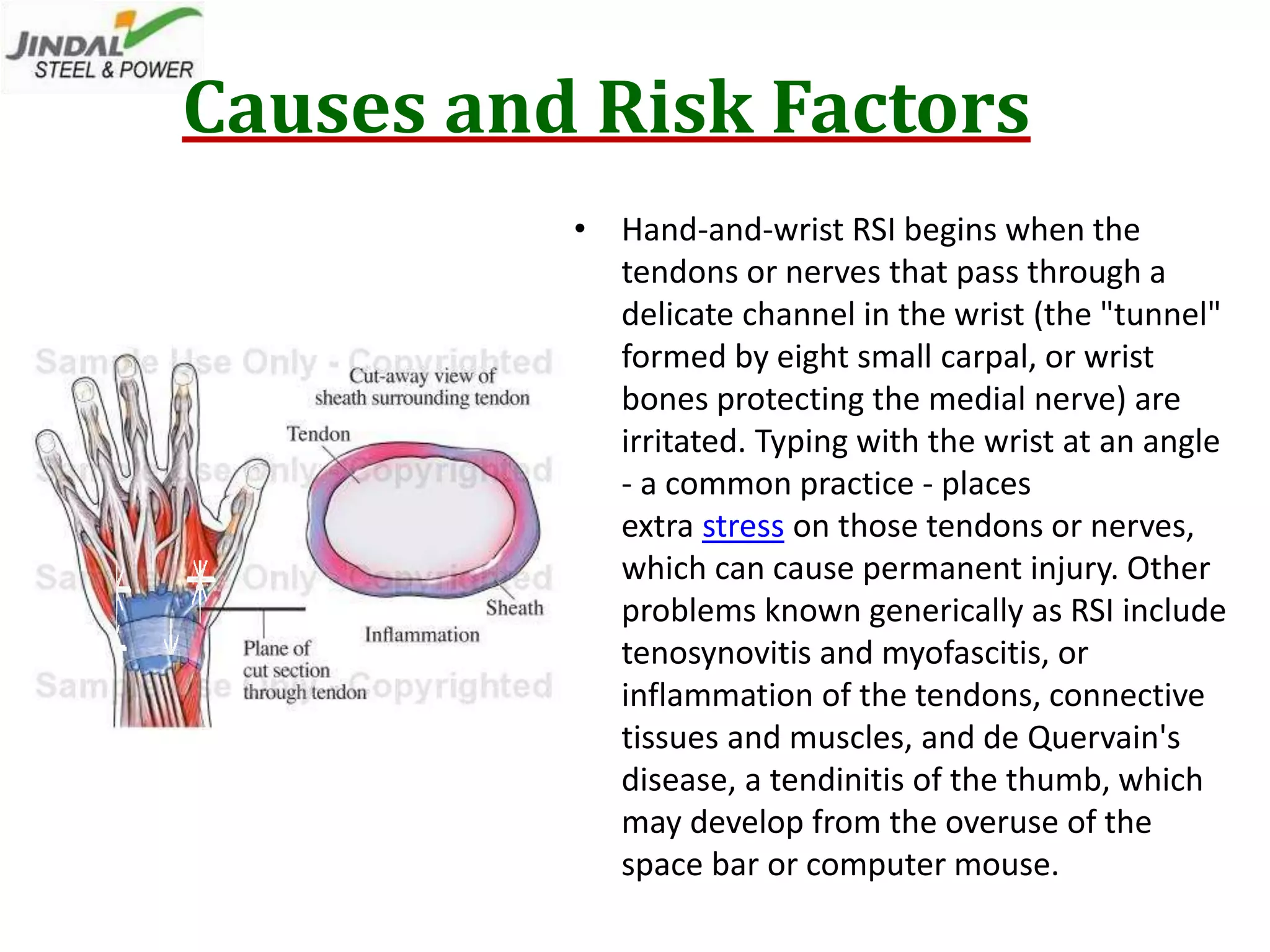 Repetitive stress injuries, prevention & management | PPTX