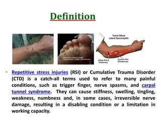 Repetitive stress injuries, prevention & management | PPTX
