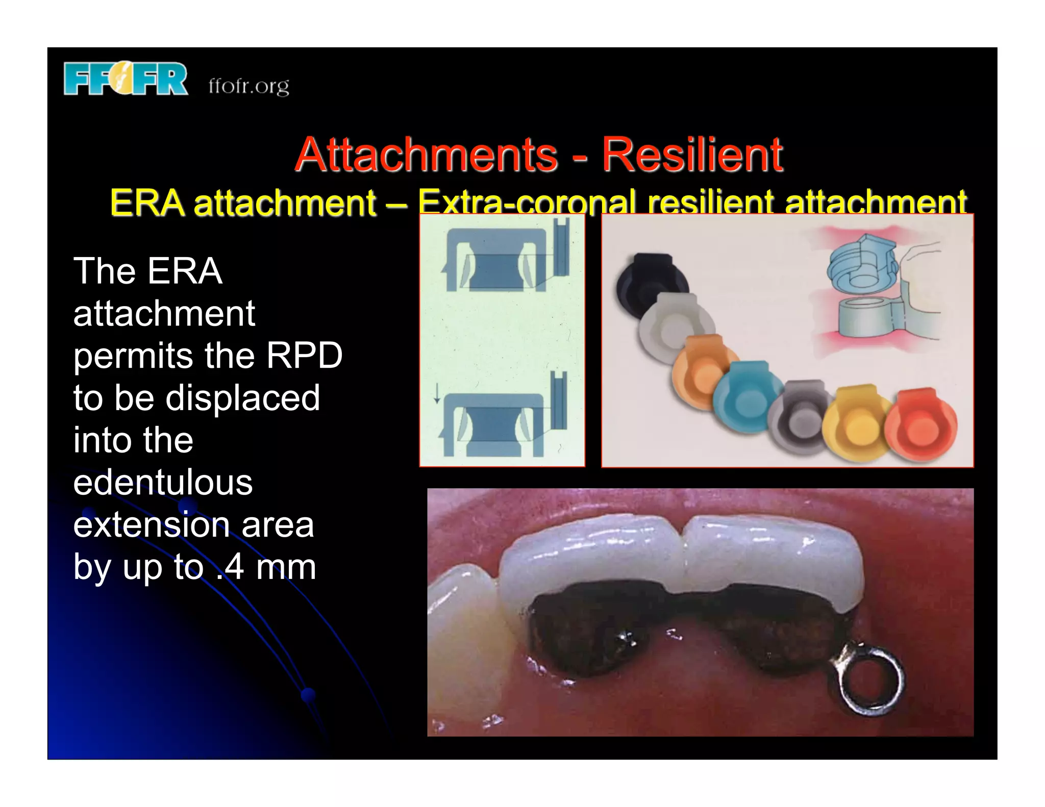 (Replace) 11.esthetics, rotational path, attachments | PDF