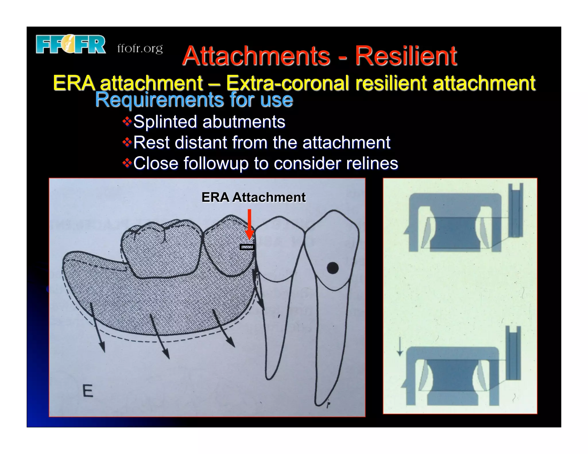 (Replace) 11.esthetics, rotational path, attachments | PDF