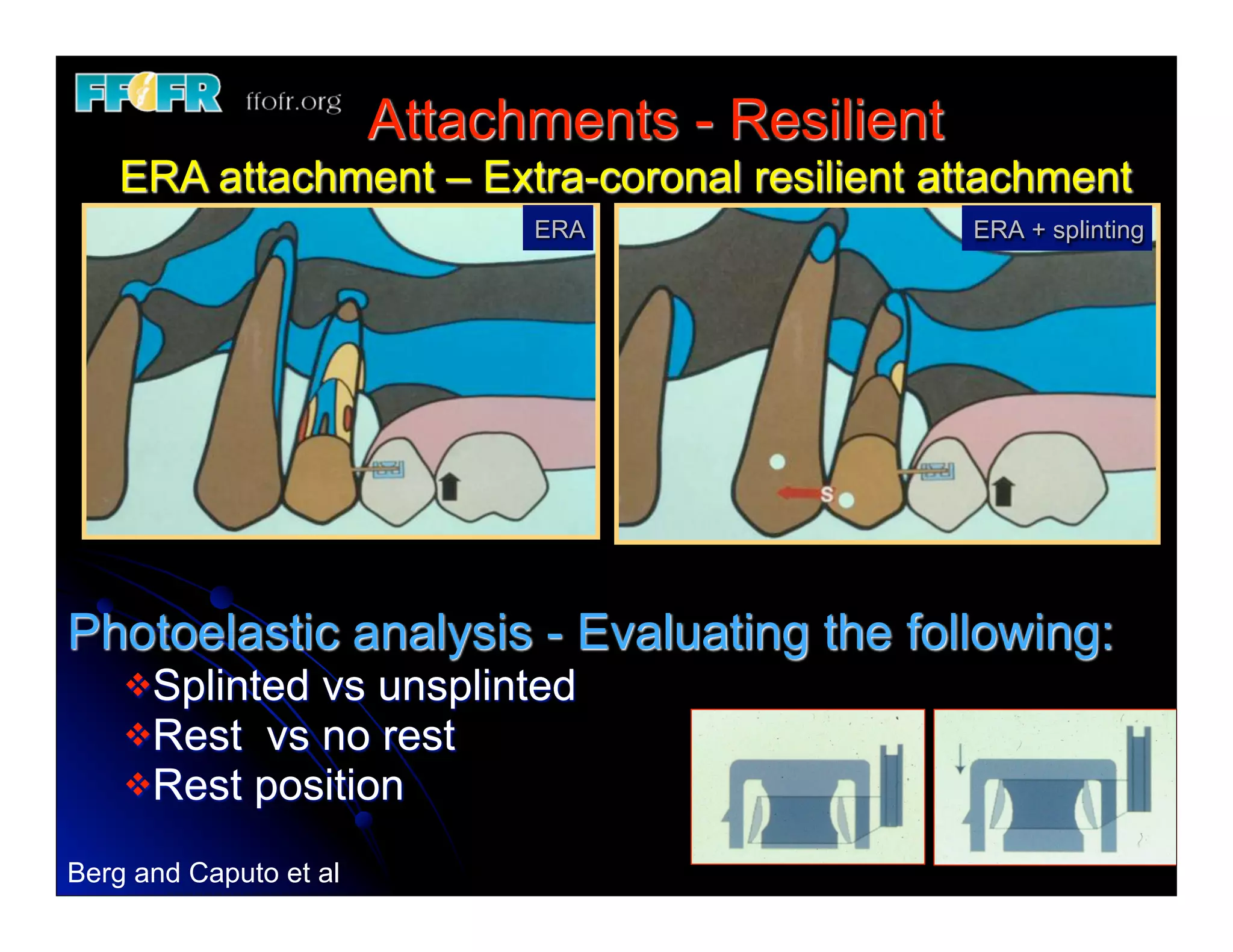 (Replace) 11.esthetics, rotational path, attachments | PDF