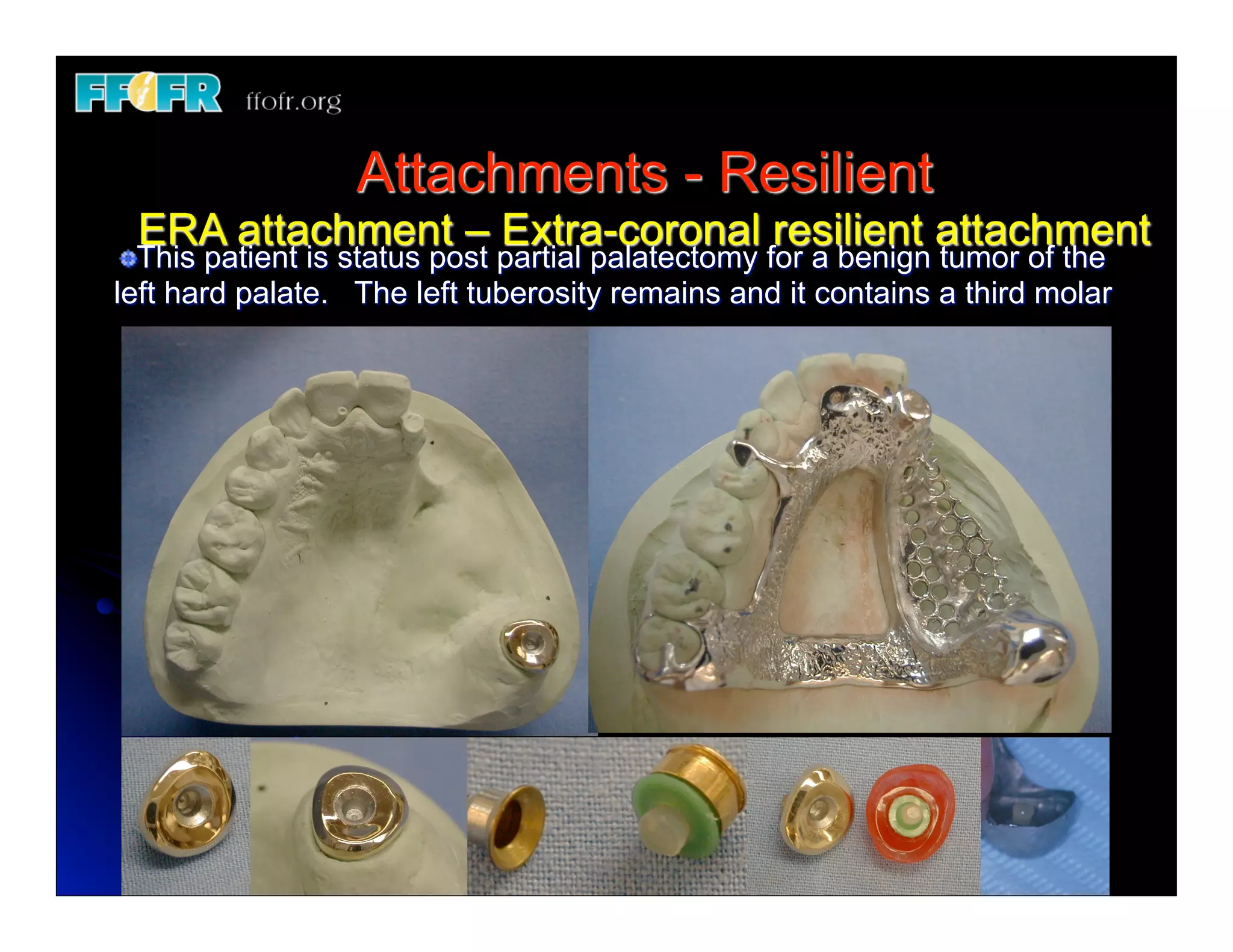 (Replace) 11.esthetics, rotational path, attachments | PDF