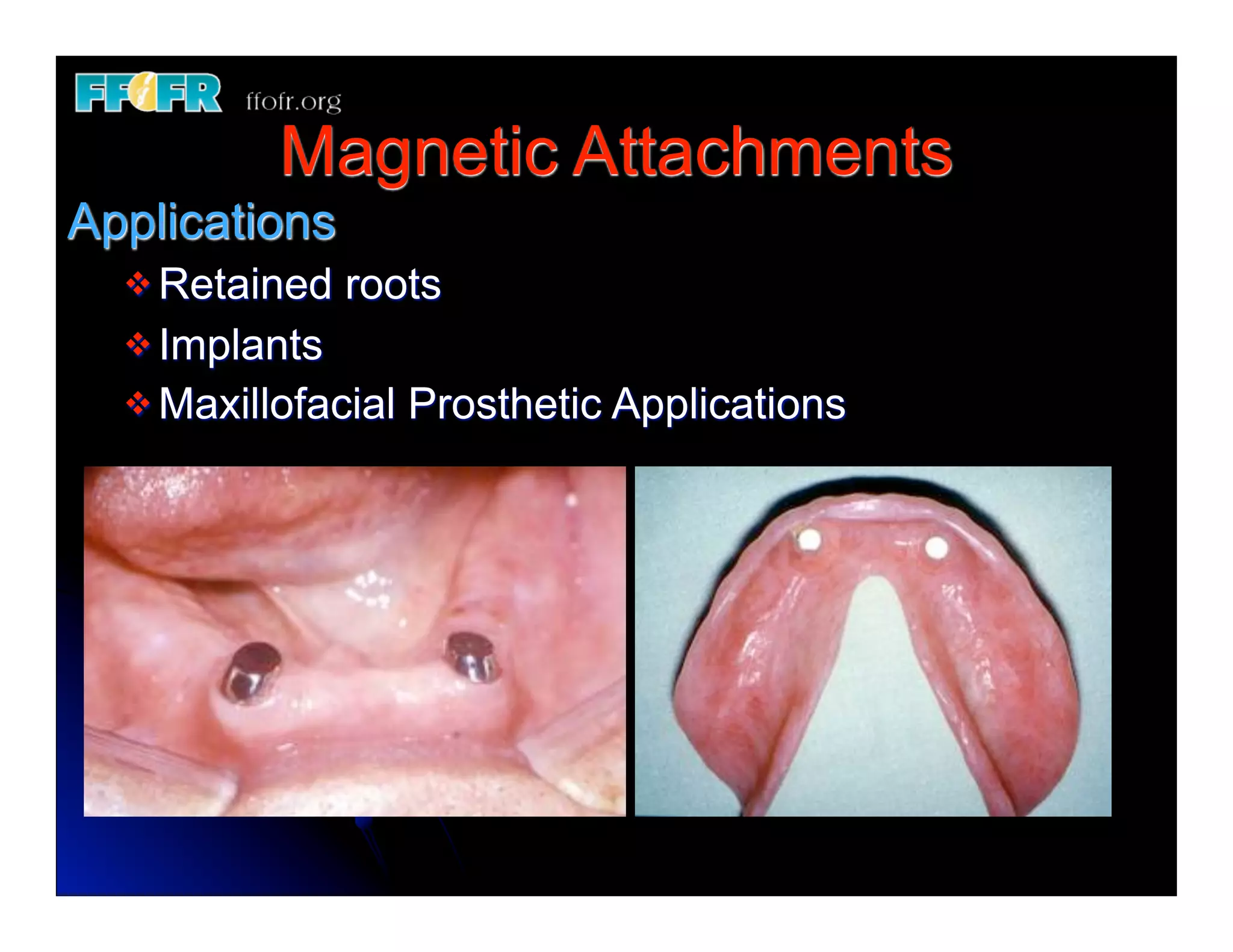 (Replace) 11.esthetics, rotational path, attachments | PDF