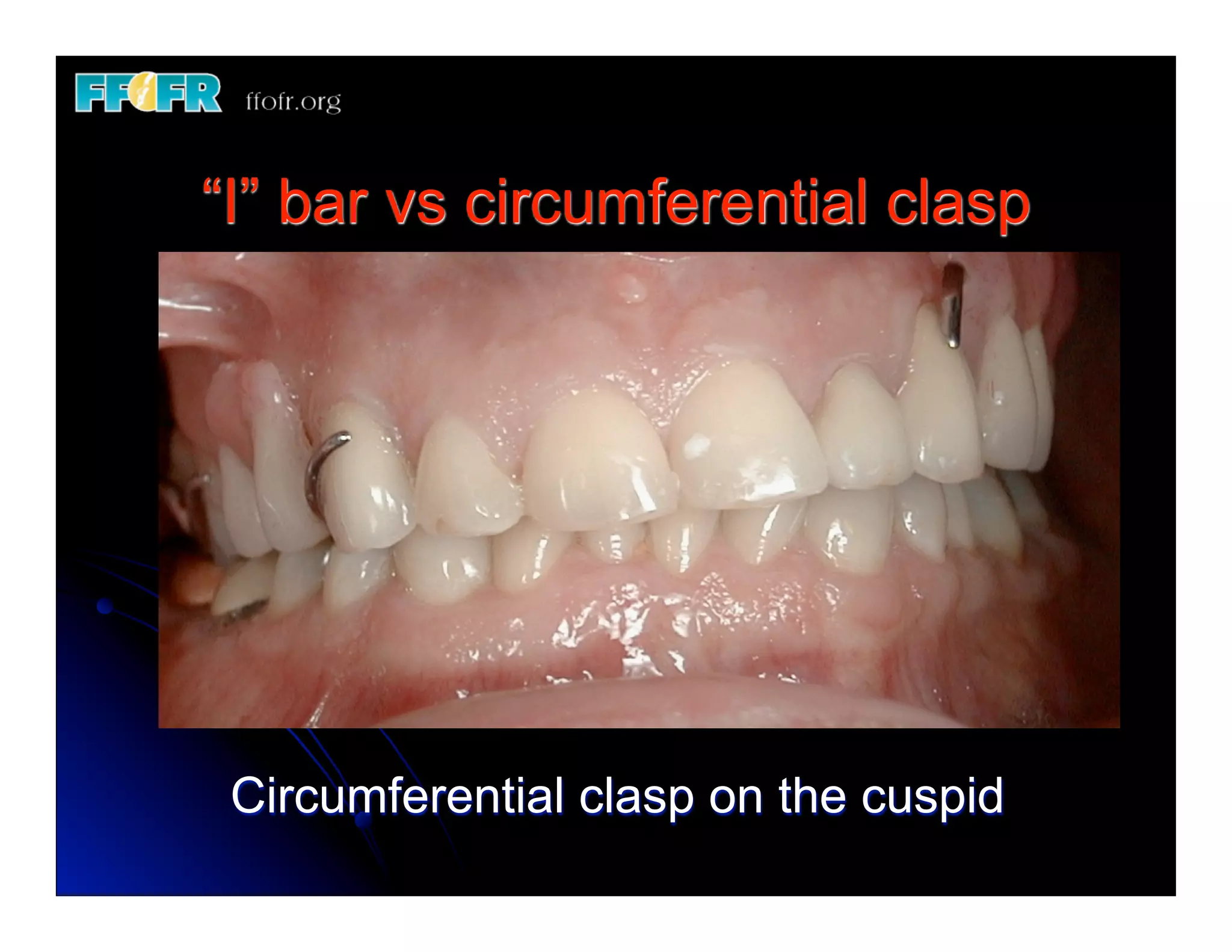 (Replace) 11.esthetics, rotational path, attachments | PDF