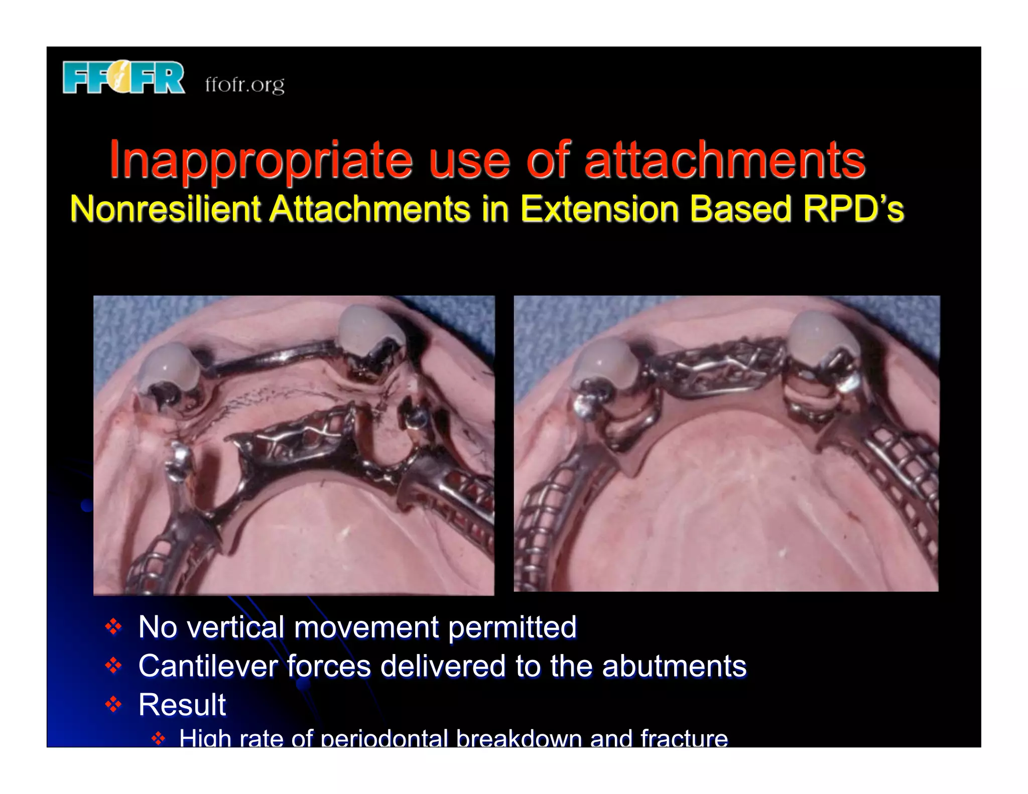 (Replace) 11.esthetics, rotational path, attachments | PDF