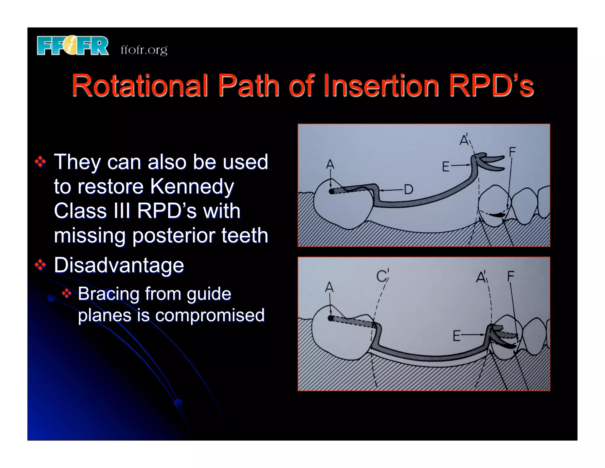 (Replace) 11.esthetics, rotational path, attachments | PDF