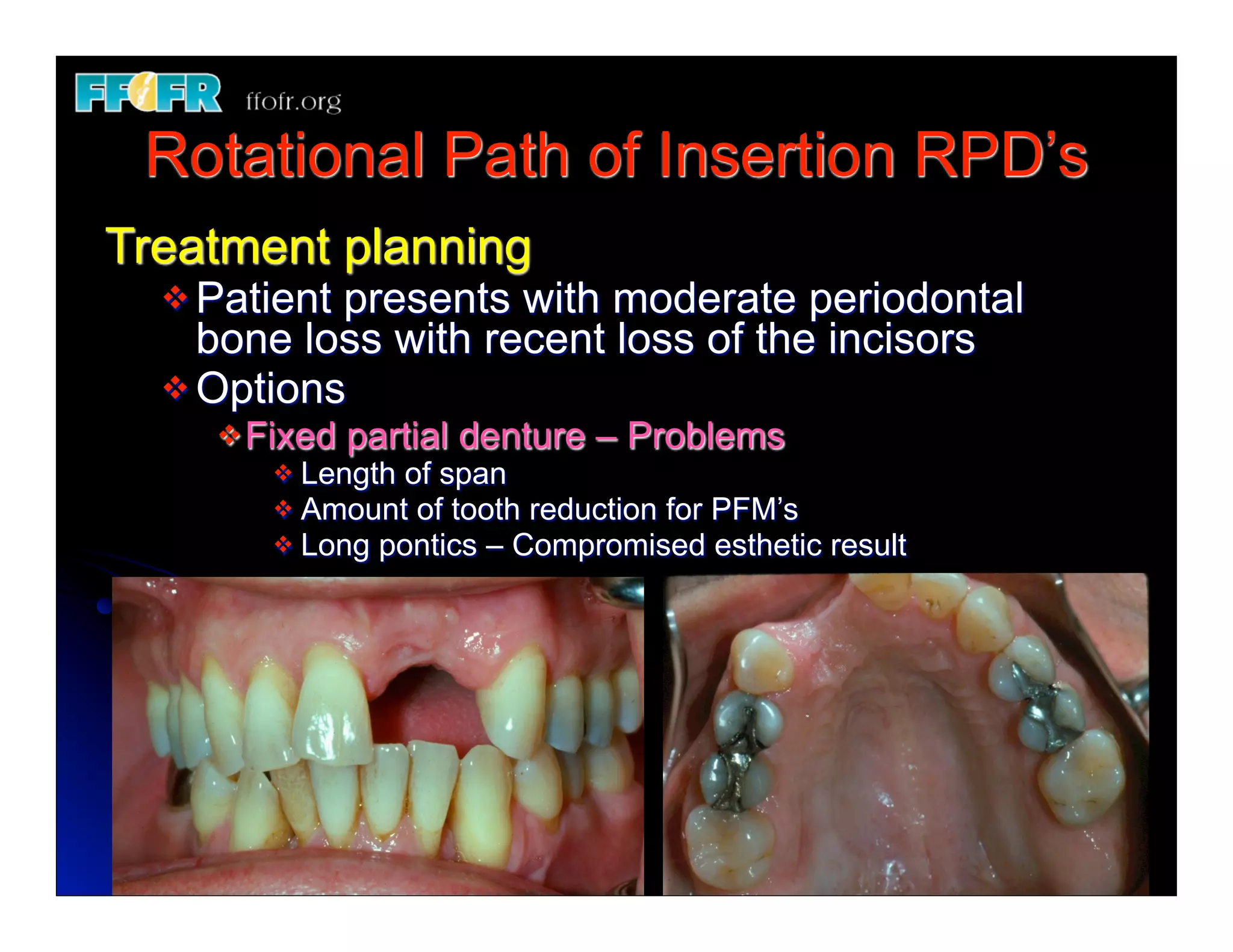 (Replace) 11.esthetics, rotational path, attachments | PDF