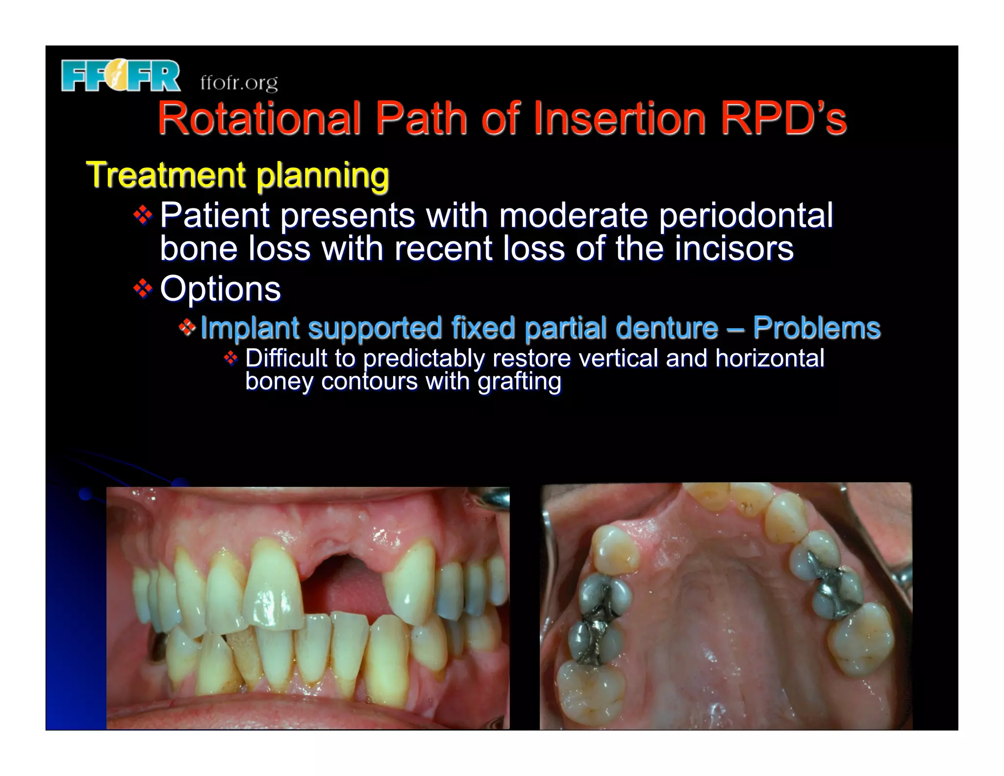 (Replace) 11.esthetics, rotational path, attachments | PDF