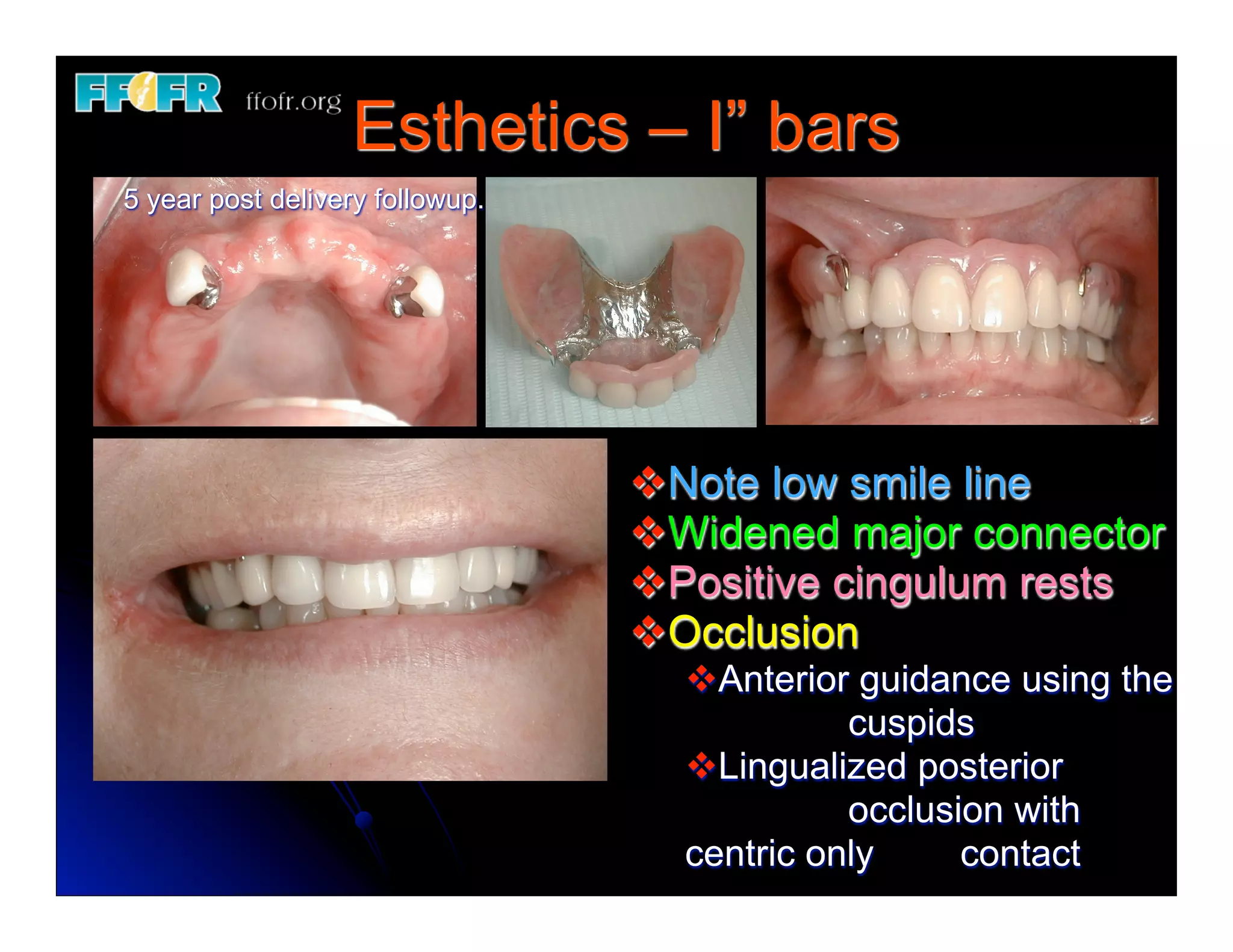 (Replace) 11.esthetics, rotational path, attachments | PDF