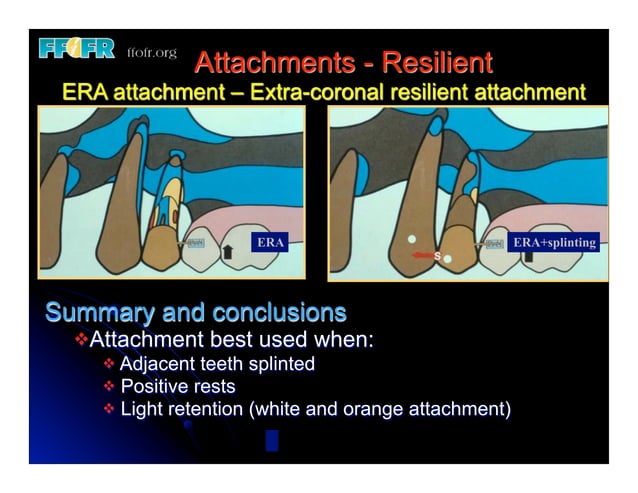(Replace) 11.esthetics, rotational path, attachments | PPT
