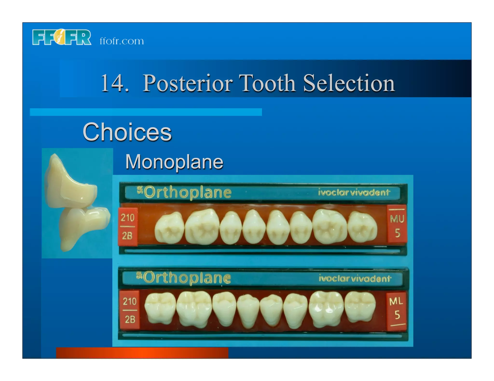 (Replace) 22.criteria for posterior tooth selection | PDF