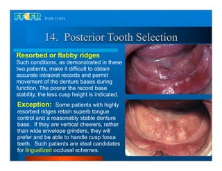 (Replace) 22.criteria for posterior tooth selection | PDF