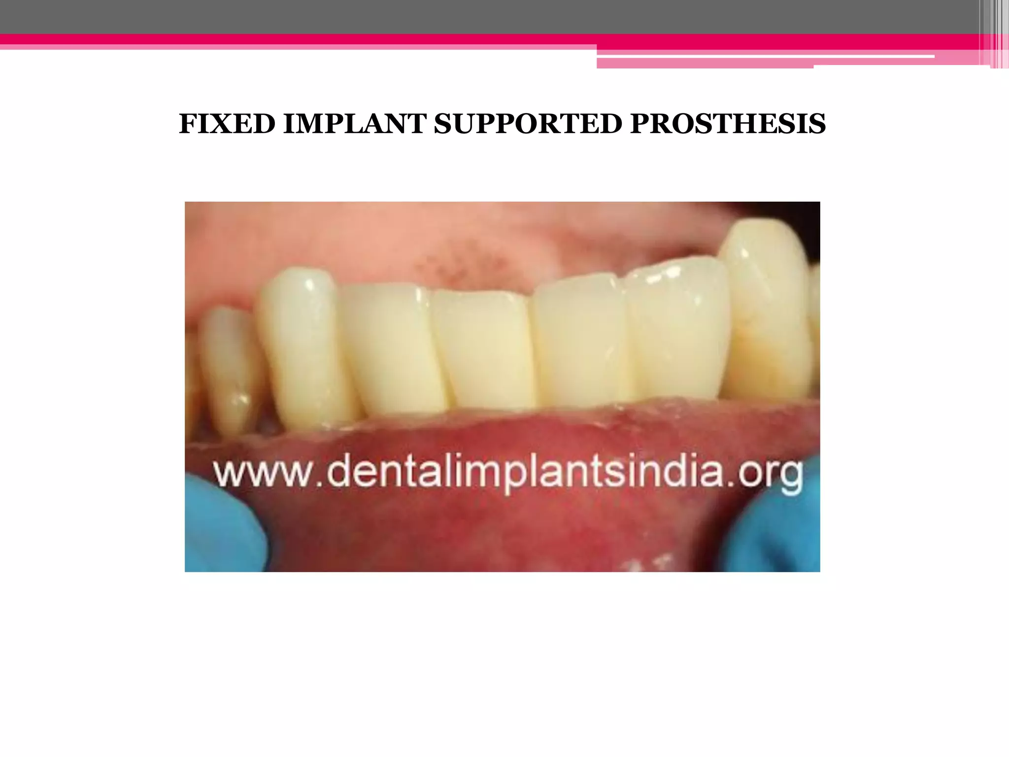 Replacement of missing lower front teeth with basal implant a case ...