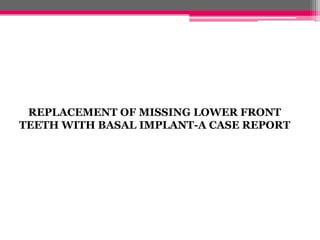 Replacement of missing lower front teeth with basal implant a case ...
