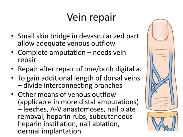 Replantation | PPTX | First Aid | Injuries