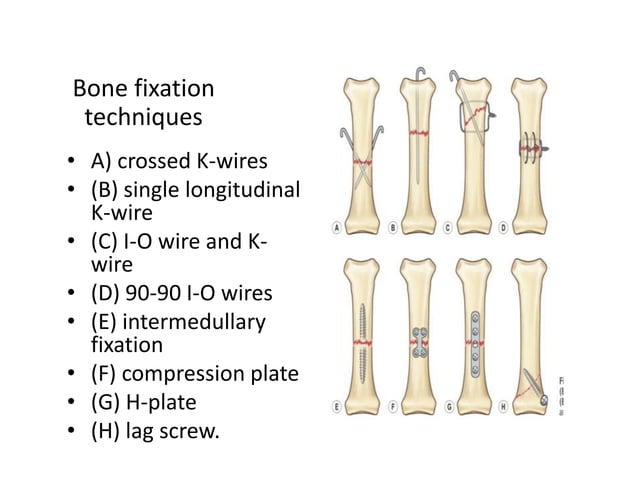Replantation of the hand and Upper extremity | PPT | First Aid | Injuries