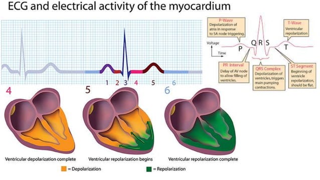 Repolarization ST wave Abnormalities | PPTX