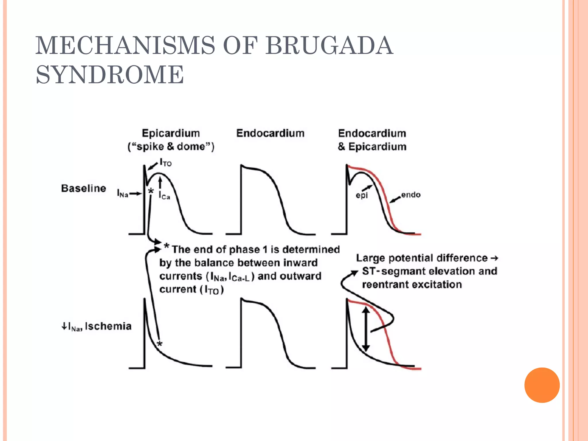 Repolarization syndromes | PPT