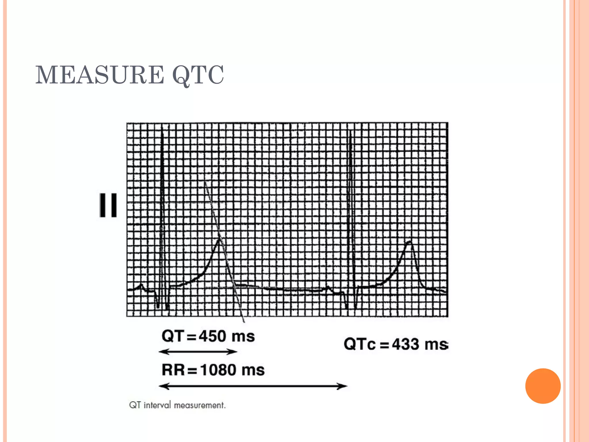 Repolarization syndromes