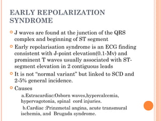 Repolarization syndromes | PPT