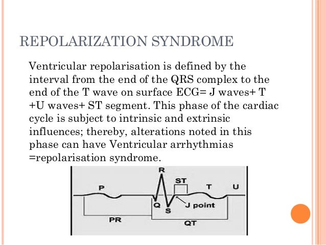Repolarization syndromes