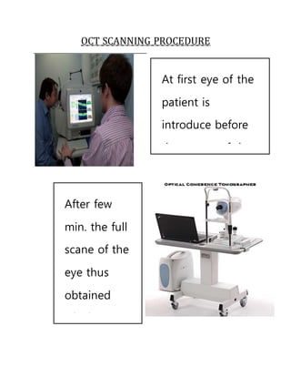 Report on EYE-OCT.(OPTICAL COHERANCE TOMOGRAPHY) | DOCX