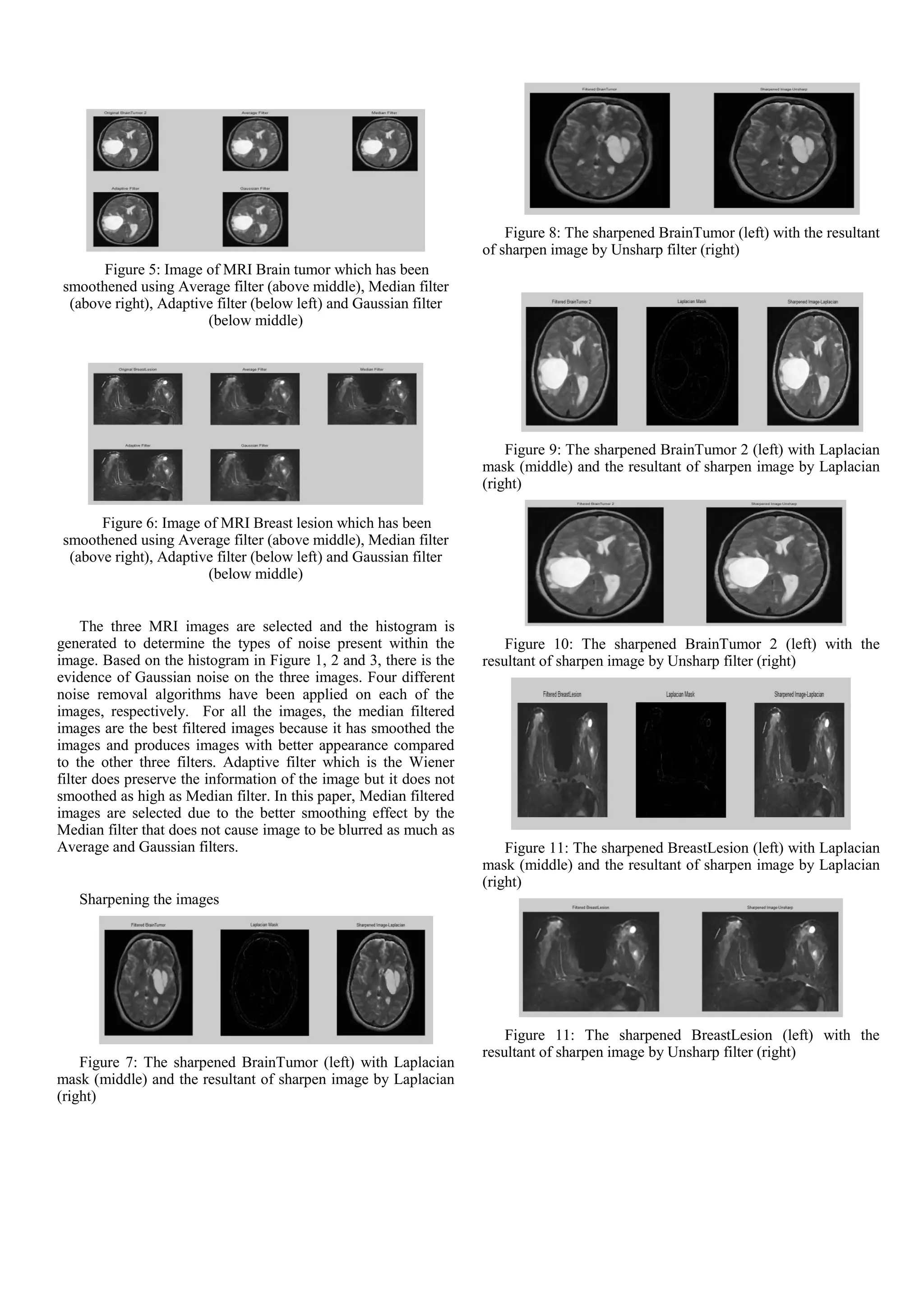 Empirical Edge Detection and Extraction of Lesion using Image Processing Technique | PDF