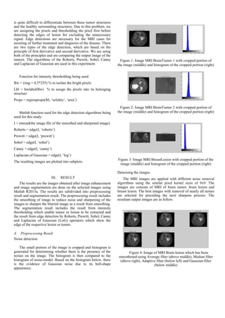 Empirical Edge Detection and Extraction of Lesion using Image Processing Technique | PDF