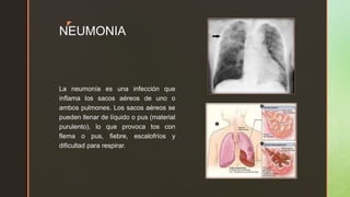 REPORTE DE ENFERMERIA DE DIFERENTES PATOLOGIAS | PPTX