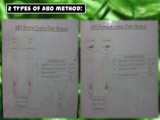 serology and immunology | PPTX