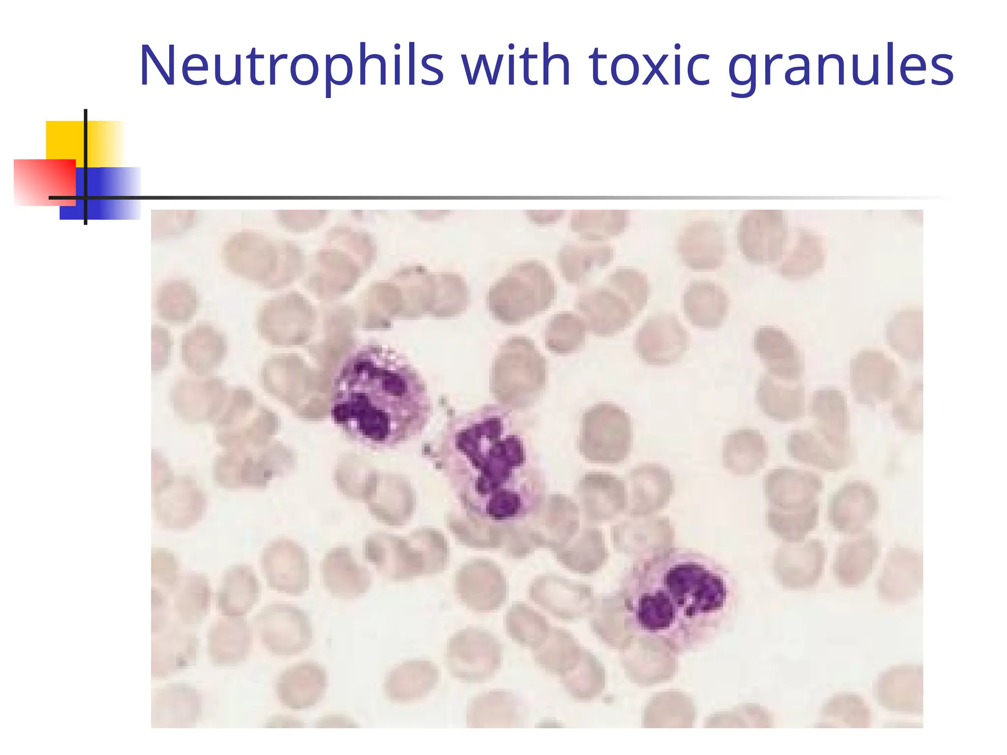 Reporting of Peripheral smear.pptx on ppt | PPT