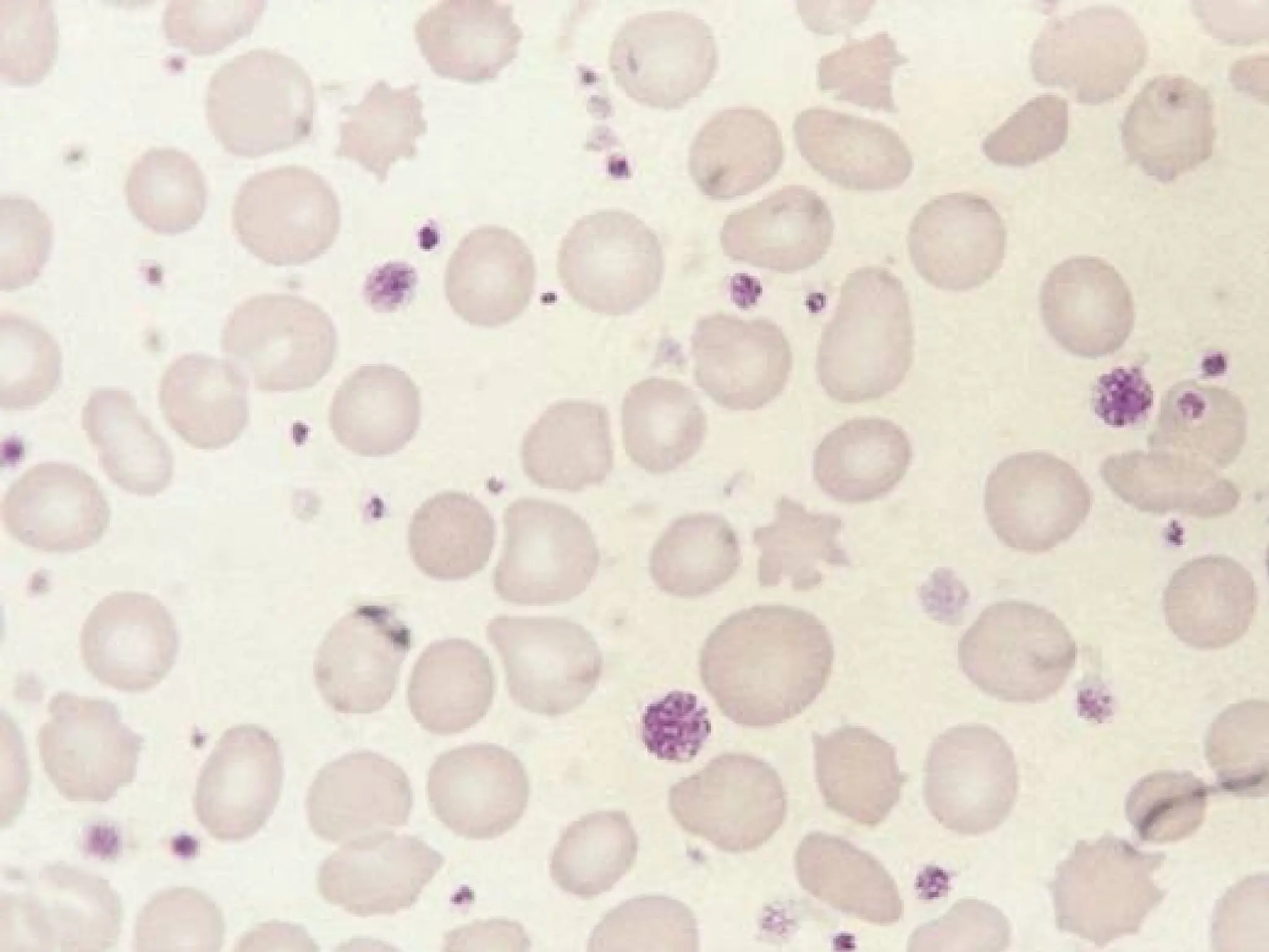 Reporting of Peripheral smear.pptx on ppt | PPT