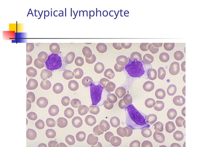 Reporting of Peripheral smear.pptx on ppt | PPT