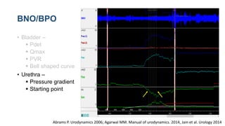 Reporting urodynamics | PPTX