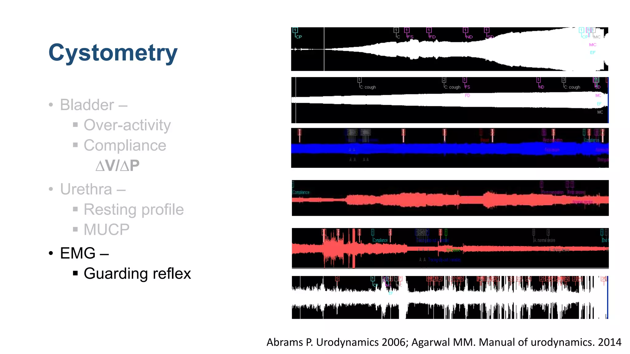 REPORTING URODYNAMIC STUDY | PPTX