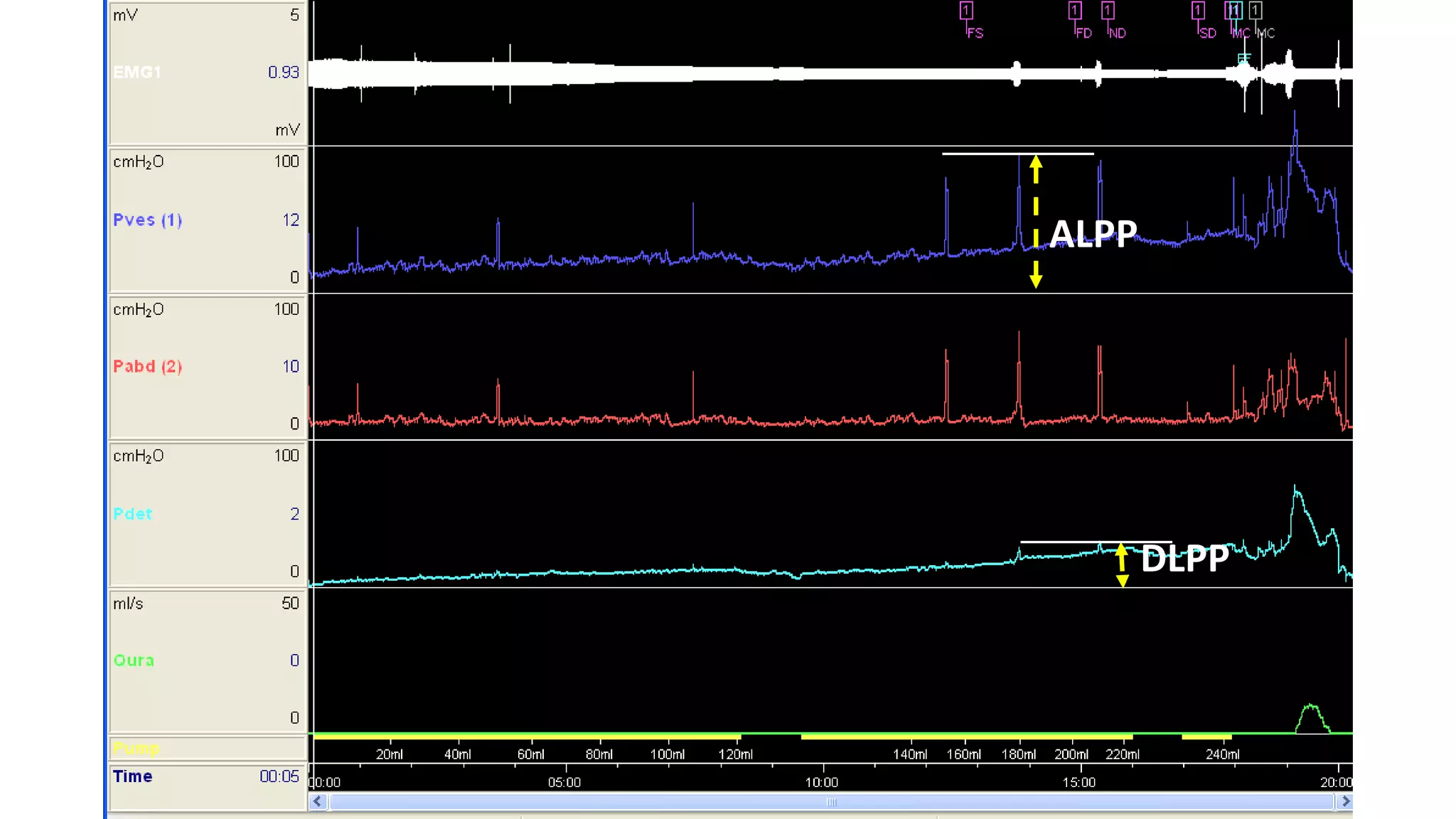REPORTING URODYNAMIC STUDY | PPTX