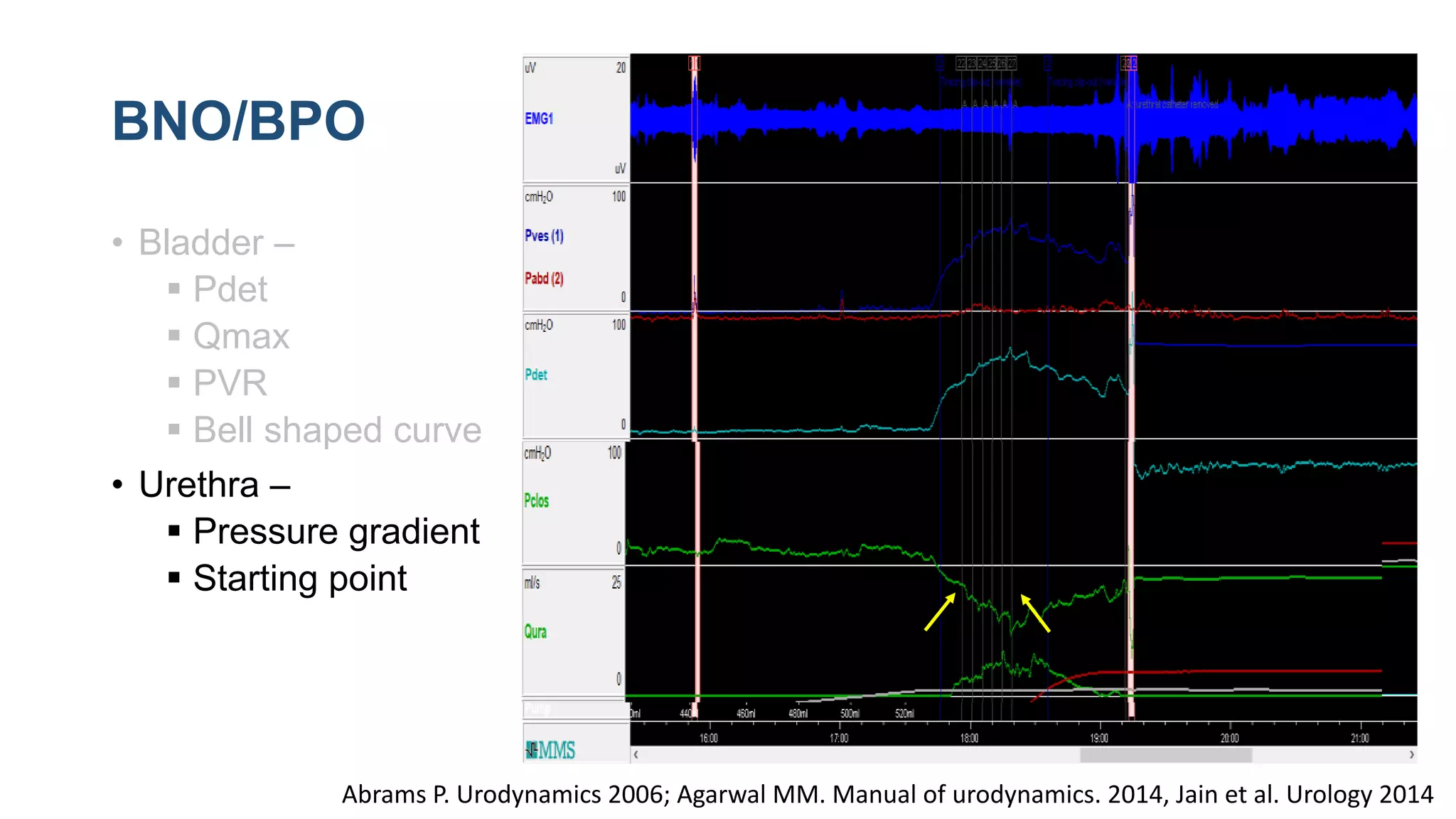 REPORTING URODYNAMIC STUDY | PPTX