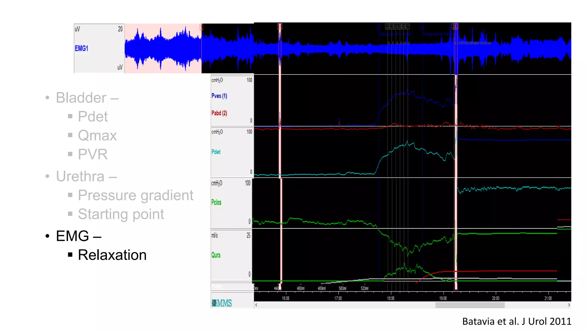 REPORTING URODYNAMIC STUDY | PPTX