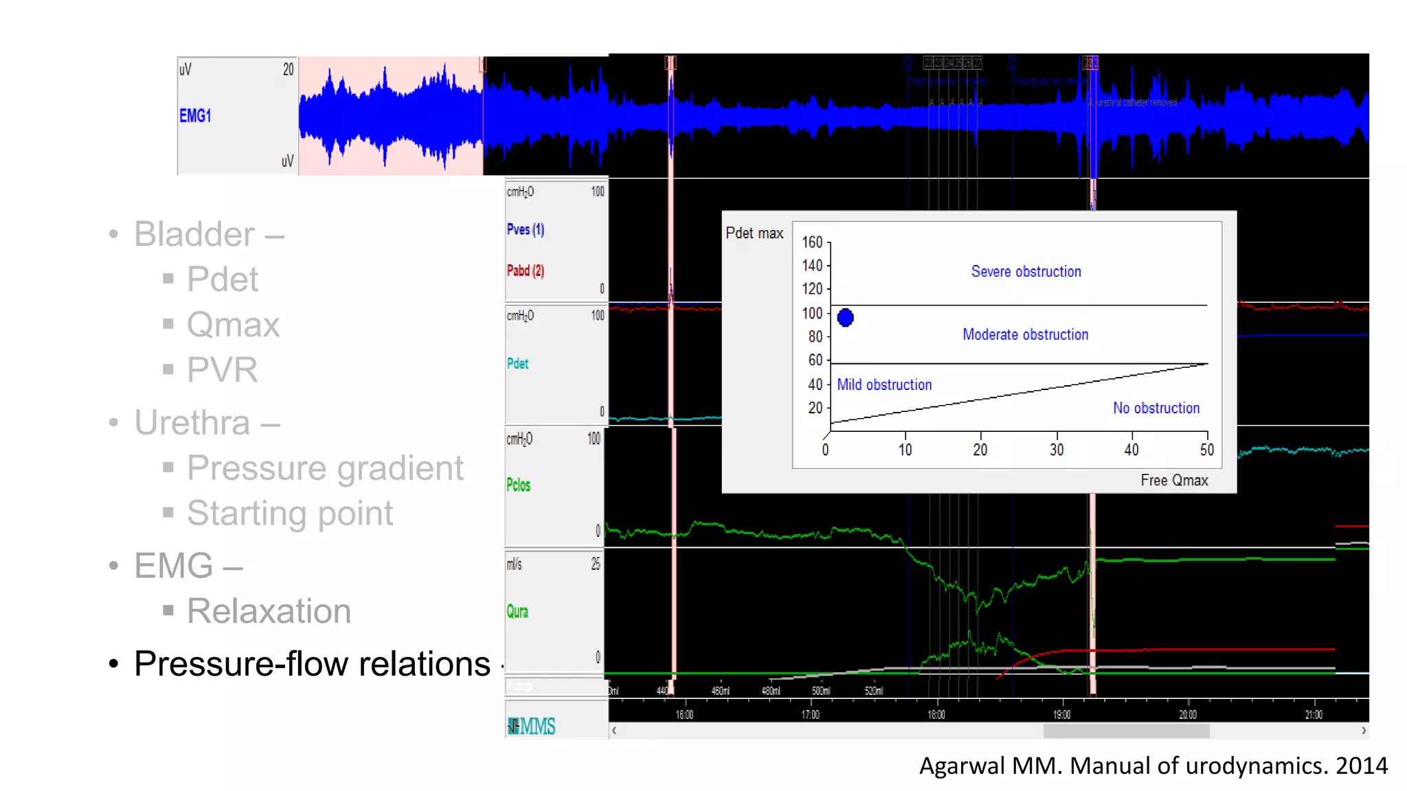 REPORTING URODYNAMIC STUDY | PPTX